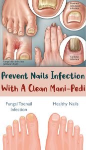 Prevent Nails Infection With A Clean Mani-Pedi - Simple Tips for You